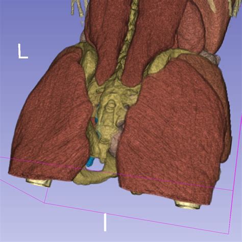 Vtk Multivolumecinematic Volume Rendering Support 3d Slicer Community