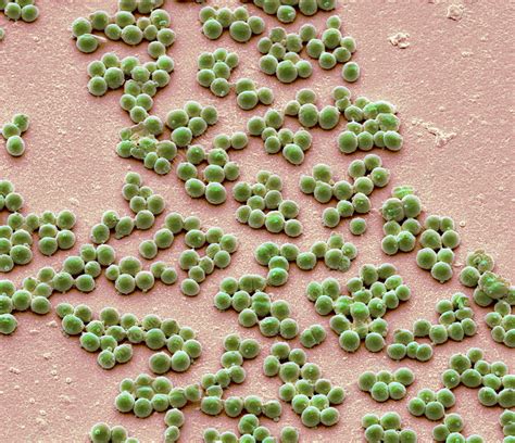 Group A Streptococcus Bacteria Sem Stock Image C057 3768 Science Photo Library