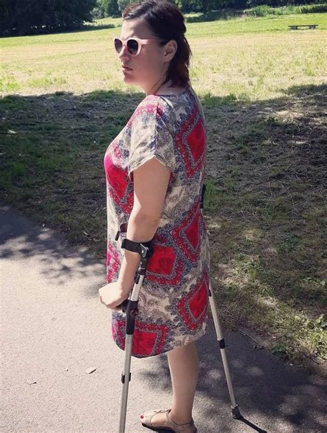 Lak Amputee On Crutches