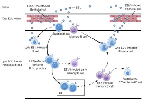 Ebv感染症 Ebウイルス しんどい Epstein Barr Virus 概説 Kzztyj