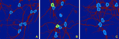 performance of soma segmentation 2d segmentation and soma detection of