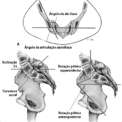 Pdf Bilateral Anterior Pelvic Osteotomy For Closure Of Bladder