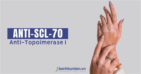 Ý Nghĩa Của Xét Nghiệm Anti Scl 70 Benhtumien