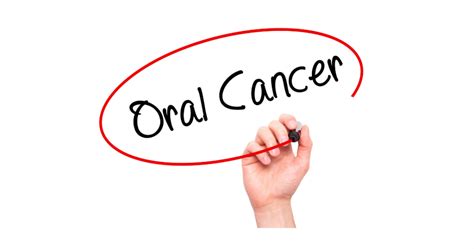 Oral Cancer Screening Dental Websites