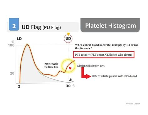 Platelets Histogram