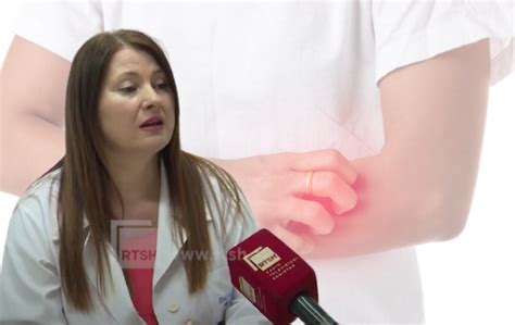 Problemet E Lëkurës Gjatë Verës Mjekja Këshillon Kujdes Të Lartë Për Personat Që Vuajnë Nga