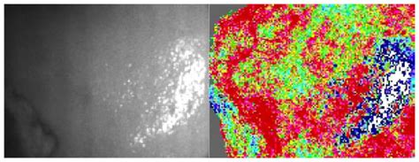 Non Invasive Imaging Of Microcirculation A Technology Review Mder