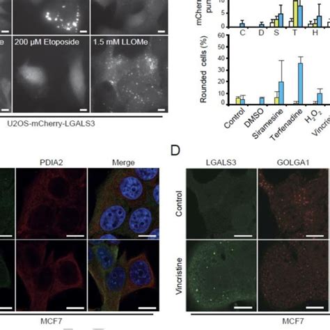 Galectin Puncta Assay Is Suitable For Automated Analysis Of Lmp A And Download Scientific