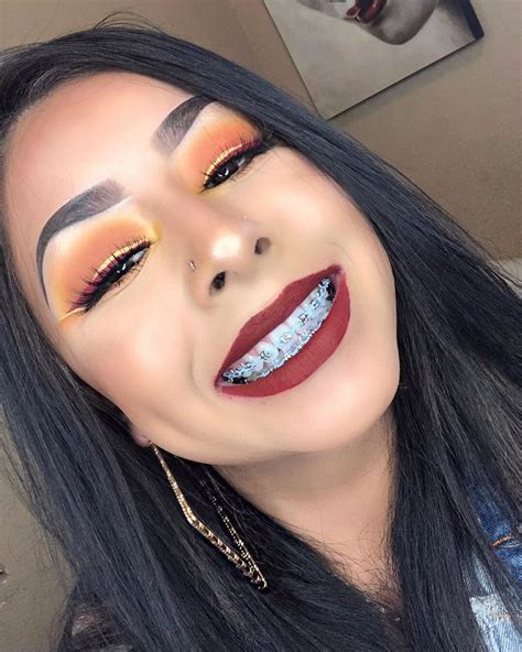 Good Braces Color Ideas At Layla Swallow Blog