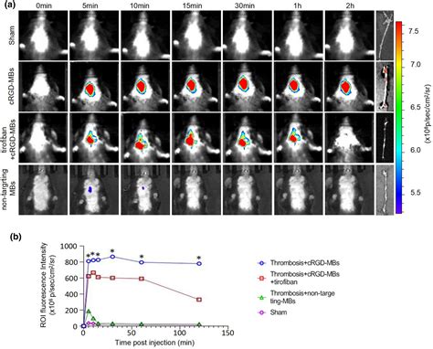 Dual‐modality Imaging For Identifying Thrombosis Via Platelet Gpiib Iiia Receptor Targeted