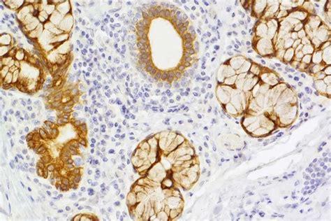 Simplifying Tissue Cross Reactivity Screening Humanized Antibodies In Human Tissue Vectorlabs