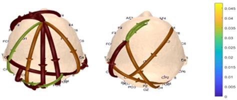 Figure 2 From Altered Functional Connectivity During Visual Working Memory State In Patients