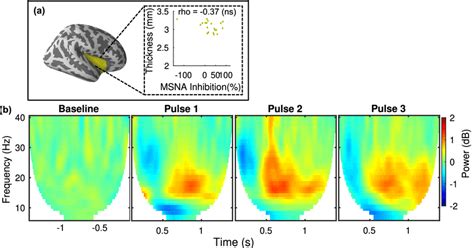 Meg Neural Oscillatory Response And Cortical Thickness In The Insula