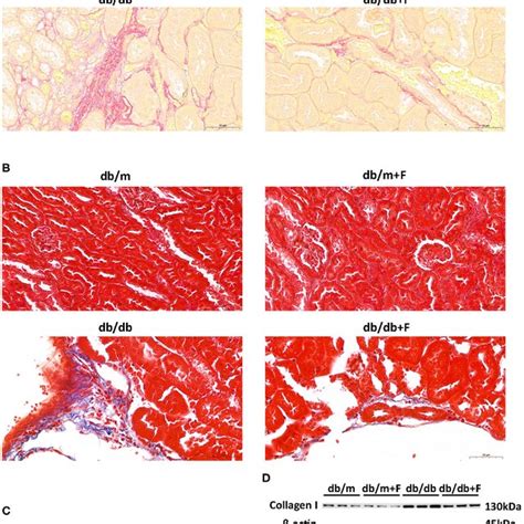 renal fibrosis in db m db m f db db and db db f groups a c download scientific diagram