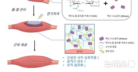 주사 한 방으로 근육 살린다 주입형 전도성 수화젤 개발 주사 한 방으로 근육 살린다 주입형 전도성 수화젤 개발