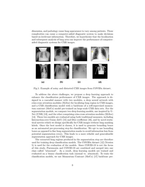 Improving Classification Model Performance On Chest X Rays Through Lung Segmentation Deepai