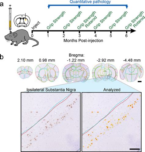 α synuclein pathology spread through the brain connectome is modulated