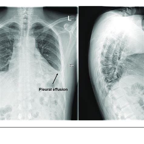 Transesophageal Echocardiography Download Scientific Diagram
