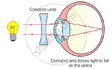 Given Below Is A Diagram Depicting A Defect Of The Human Eye Study The Same And Then Answer The