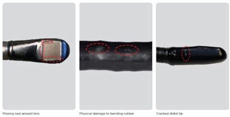 Sponsored 2020 Imaging Insights Minimizing Costly Tee Probe