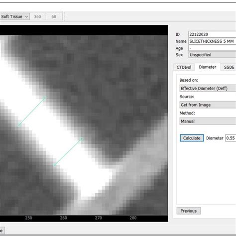 the steps of automated approach of slice thickness measurement a ct
