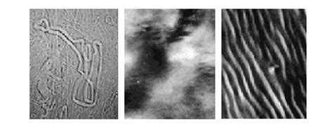 Optical Anisotropic Textures Observed By Polarising Microscopy At 20