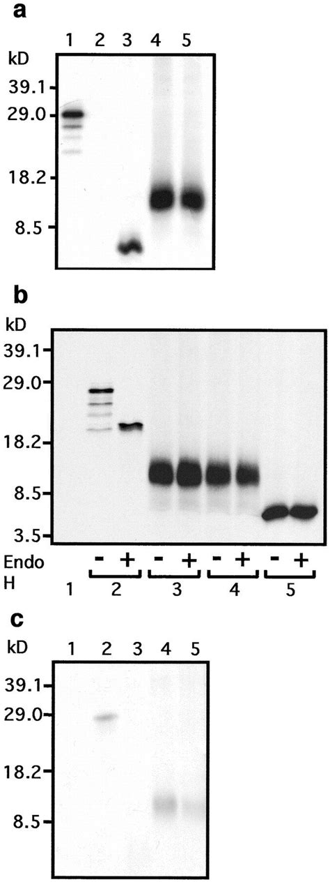 Clnx Coimmunoprecipitates With The Cooh Terminus Of Serca2b In Vitro