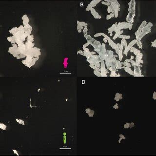 Sex Toy Microplastic Microscope Images All Scale Bars Read M A Download Scientific Diagram