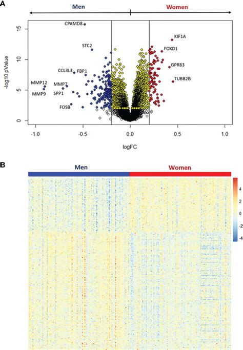 Sex Specific Cell Types And Molecular Pathways Indicate Fibro Calcific Sex Specific Cell Types And Molecular Pathways Indicate Fibro Calcific