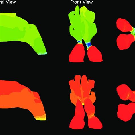 Pre And Postoperative Airflow Pressure Distribution Of The Nasal Cavity Download Scientific