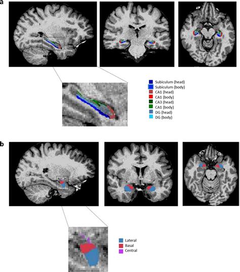 Segmentation Of Hippocampus And Amygdala Subfields Automatic