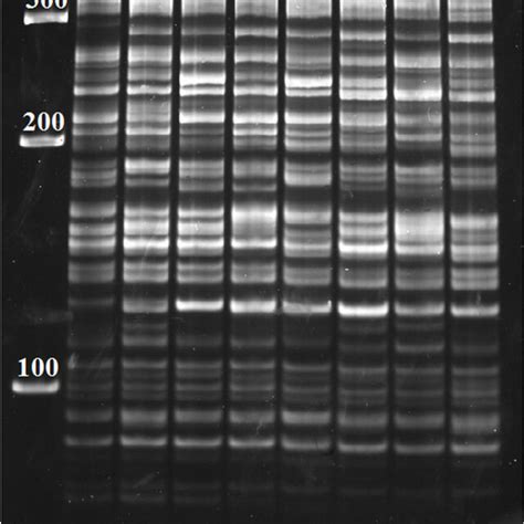 Electropherogram Of Aflp Fragments Produced Through The Analysis Of