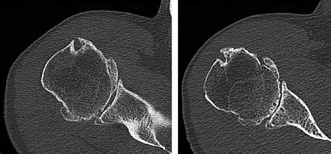 Example Of A Shoulder Scan Acquired With The Pre Clinical Hybrid Download Scientific Diagram
