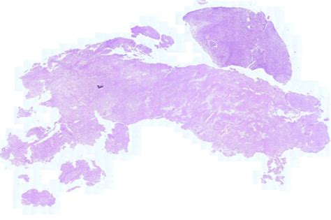 India Pathology Dataset Ipd