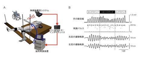 手から生体信号を腰椎へバイパスする非侵襲の人工神経接続システムを開発 東京都医学総合研究所など Med It Tech