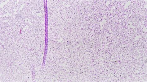 Section Of Agaricus Magnified 200x Under Microscope In Scientific