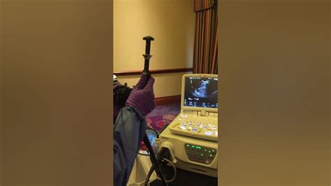 Axios Technical Steps For Deployment In Cystgastrostomy Youtube