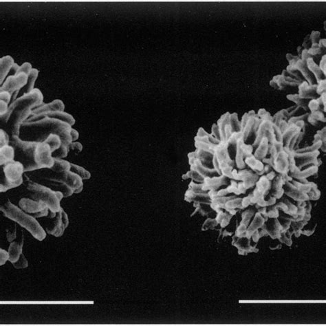 Scanning Electron Micrographs Of Spores Of Macowanites Luteiroseus