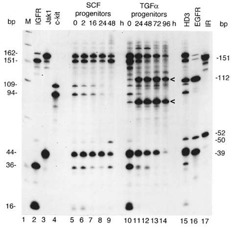 domain directed differential display of tyrosine kinase gene expression