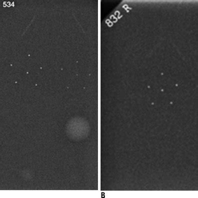 Comparison Of Characteristics Between ACR Phantom And Digital Phantom Download Scientific Diagram