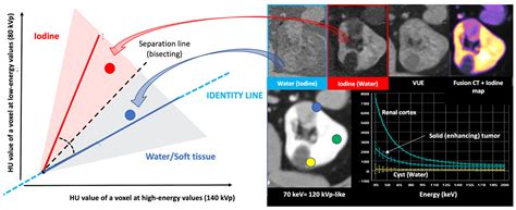 What To Expect And What Not From Dual Energy Ct Imaging Now And In