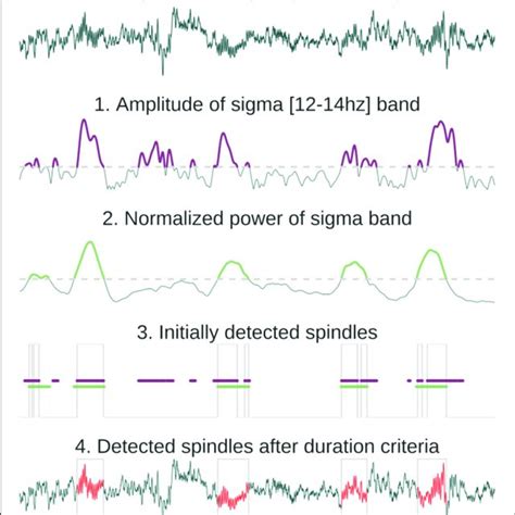 Example Of Bandpass Filtering Using The Tools Panel Left The Eeg