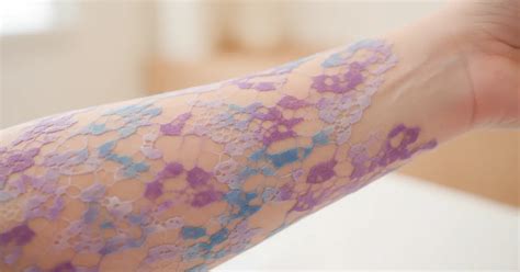 Mottled Skin Livedo Reticularis Causes Symptoms And When To Worry