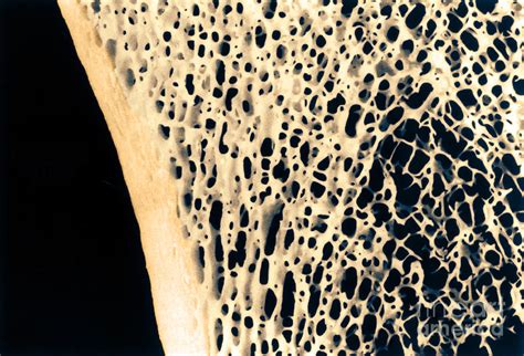 Tibia Proximal End Photograph By Don W Fawcett Pixels