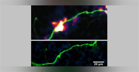 Material Made Of Fluorescent Nanosensors May Boost Neural Discoveries Laser Focus World