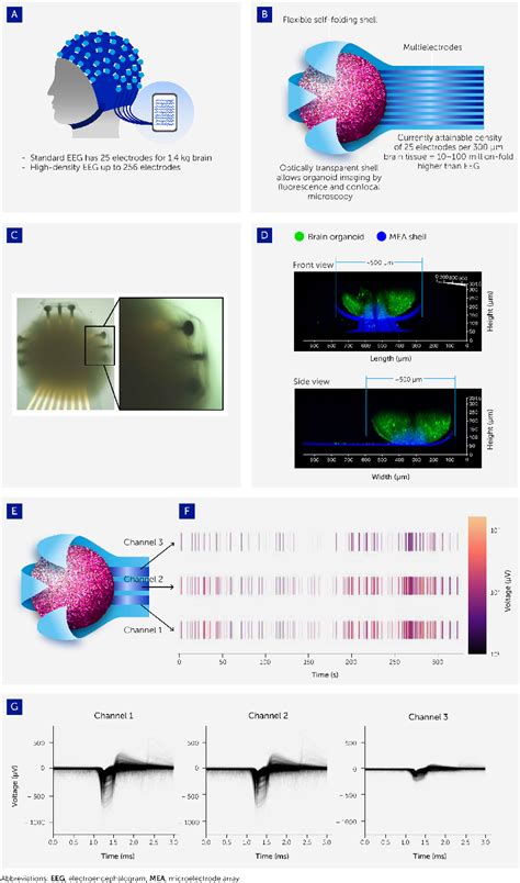 Organoid Intelligence Oi The New Frontier In Biocomputing And Intelligence In A Dish