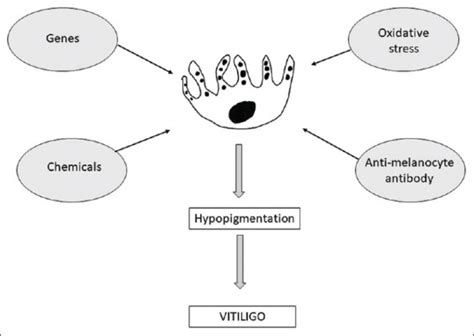 Melanogenesis And Hypopigmentation The Case Of Vitiligo Pmc