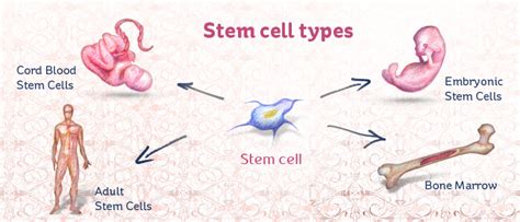 Трансплантация на стволови клетки Bridge Medical