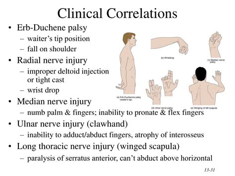 Ppt Chapter 13 The Spinal Cord And Spinal Nerves Powerpoint Presentation Id4193873