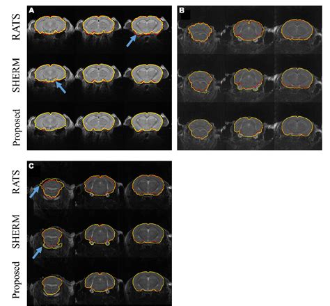 Figure From Automated Skull Stripping In Mouse Functional Magnetic Resonance Imaging Analysis